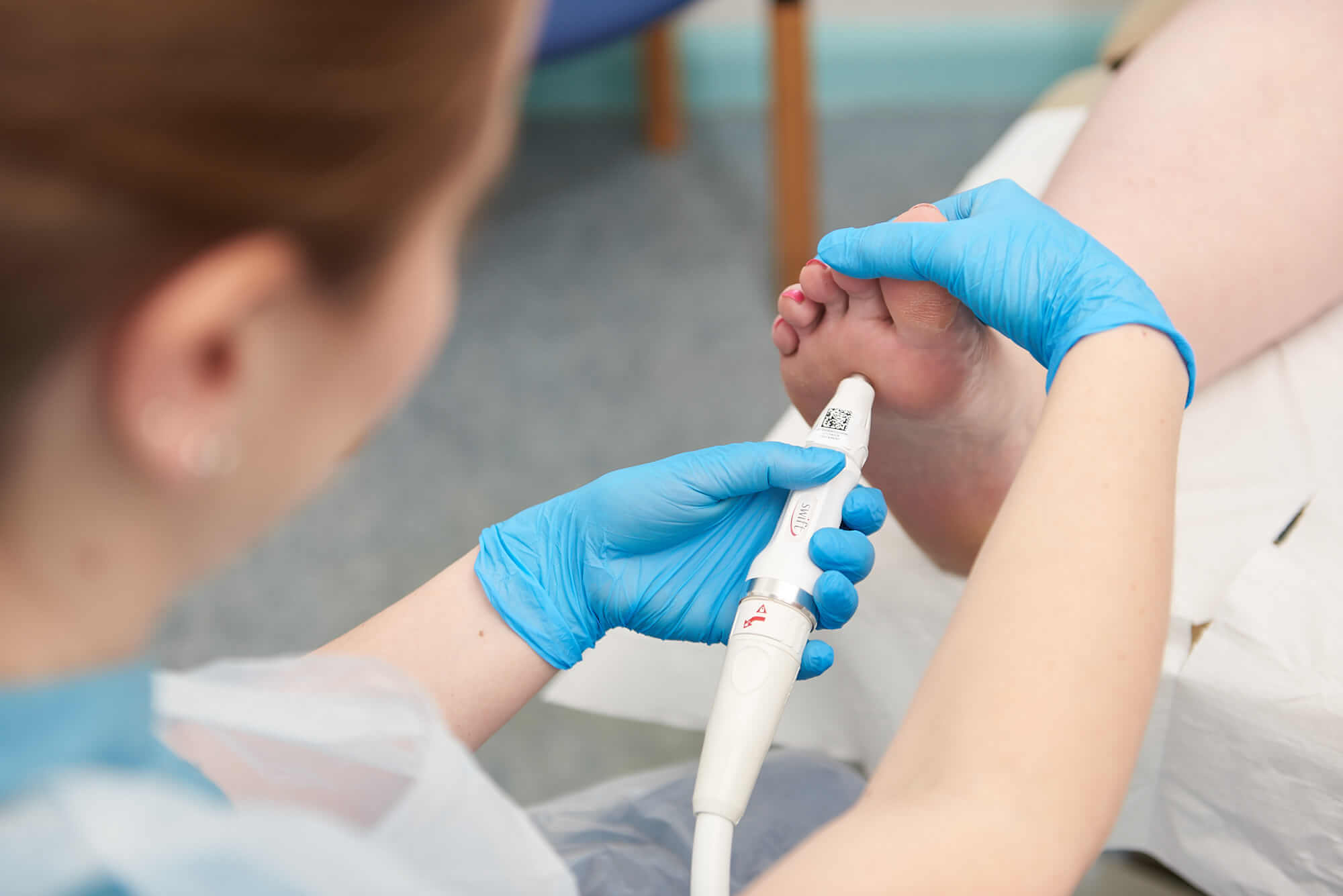 Microwave Verruca Treatment Technology - Round House Podiatry